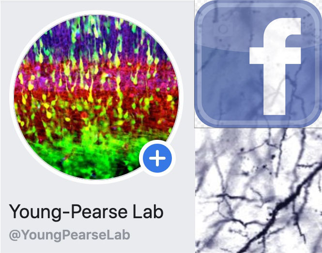 Tracy Young-Pearse PhD - Young-Pearse Lab